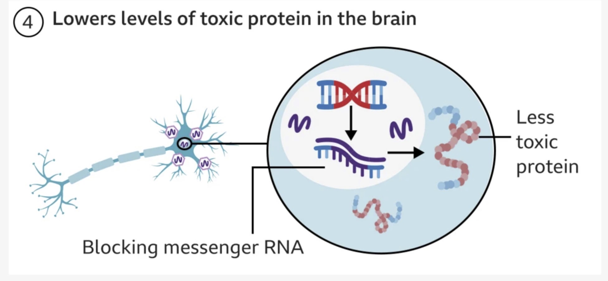 Gene Therapy in Huntington’s Disease 🧬 !! – Genomics For Dummies