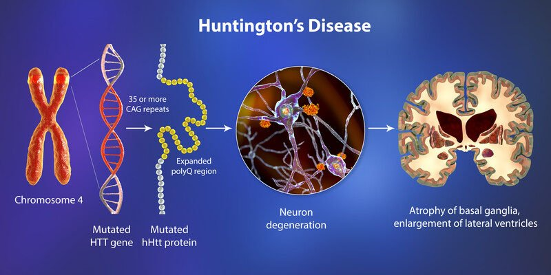 Gene Therapy in Huntington’s Disease 🧬 !! – Genomics For Dummies